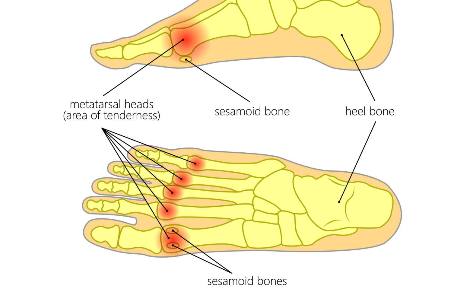 Common Conditions - Marie Whitfield Podiatry